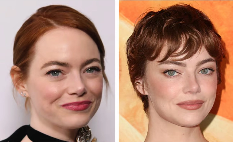 What Has Emma Stone Done to Her Face? | LIN